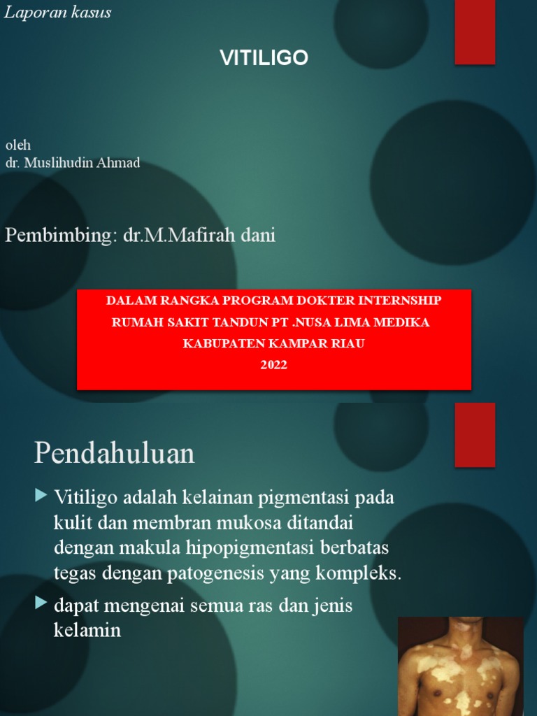 Lapkas Vitiligo | PDF