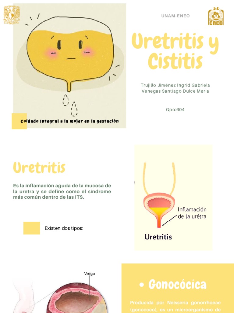 Uretritis y Cistitis | PDF | Vejiga urinaria | Infección del tracto ...