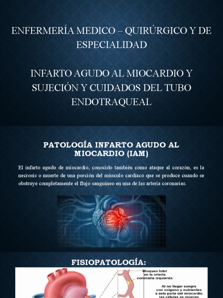 Infarto Agudo de Miocardio: Diagnóstico y Tratamiento | PDF | Infarto ...