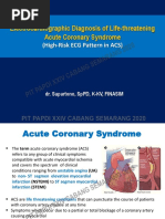 Ecg Interpretation J Point Stemi Criteria Equivalents and Others | PDF ...