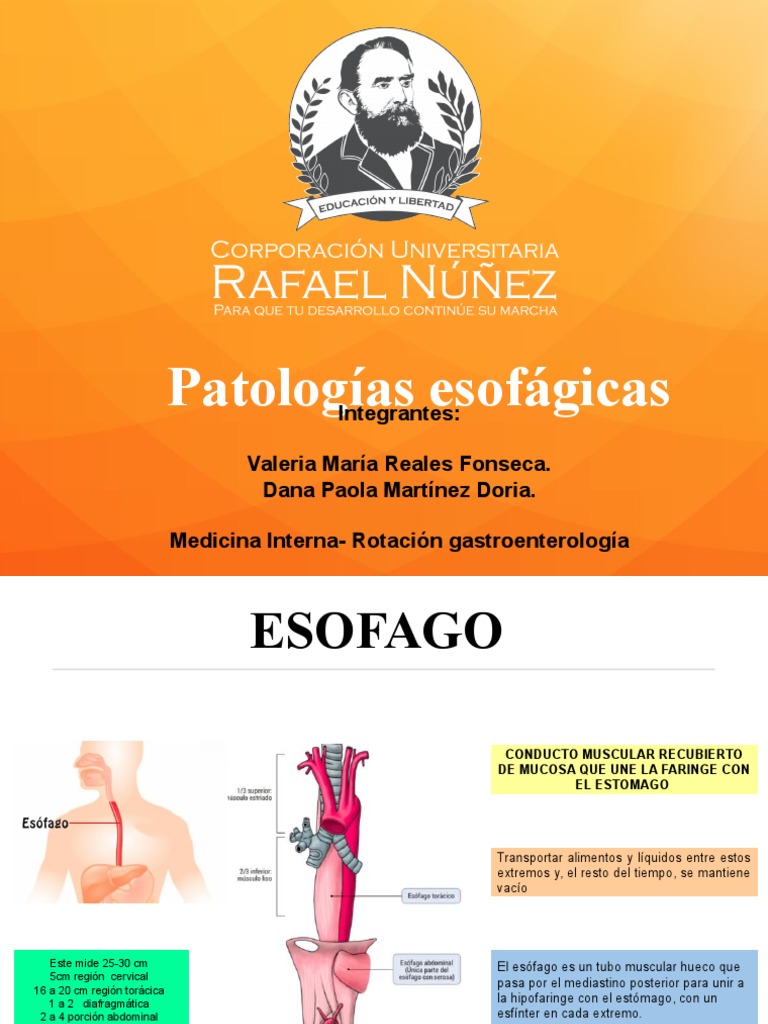 Diapositivas Patologias Esofagicas | PDF | La enfermedad por reflujo ...