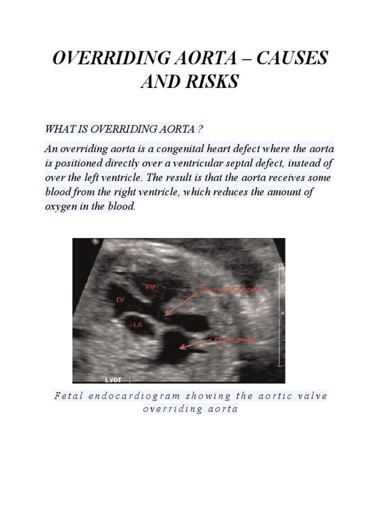 Overriding Aorta - Causes and Risks | PDF | Congenital Heart Defect ...