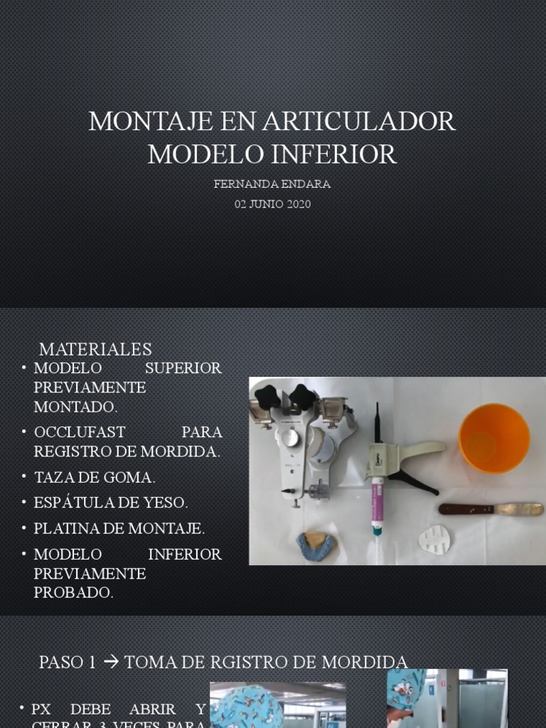 Montaje en Articulador Modelo Inferior | PDF Montaje en Articulador Modelo Inferior | PDF