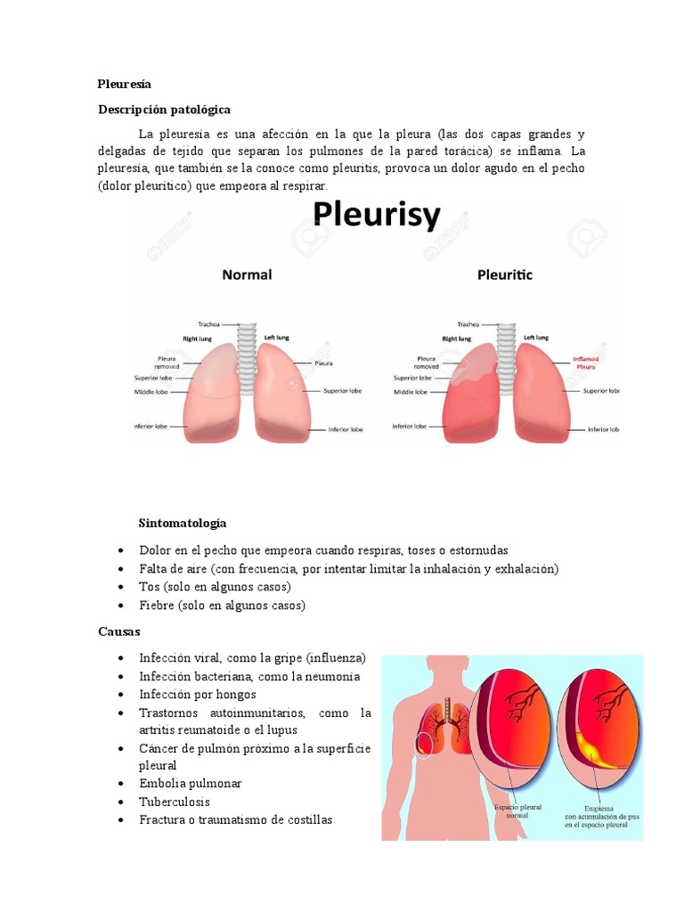 Pleuresía y Fibrosis Pulmonar | PDF | Especialidades Medicas | Ciencias ...