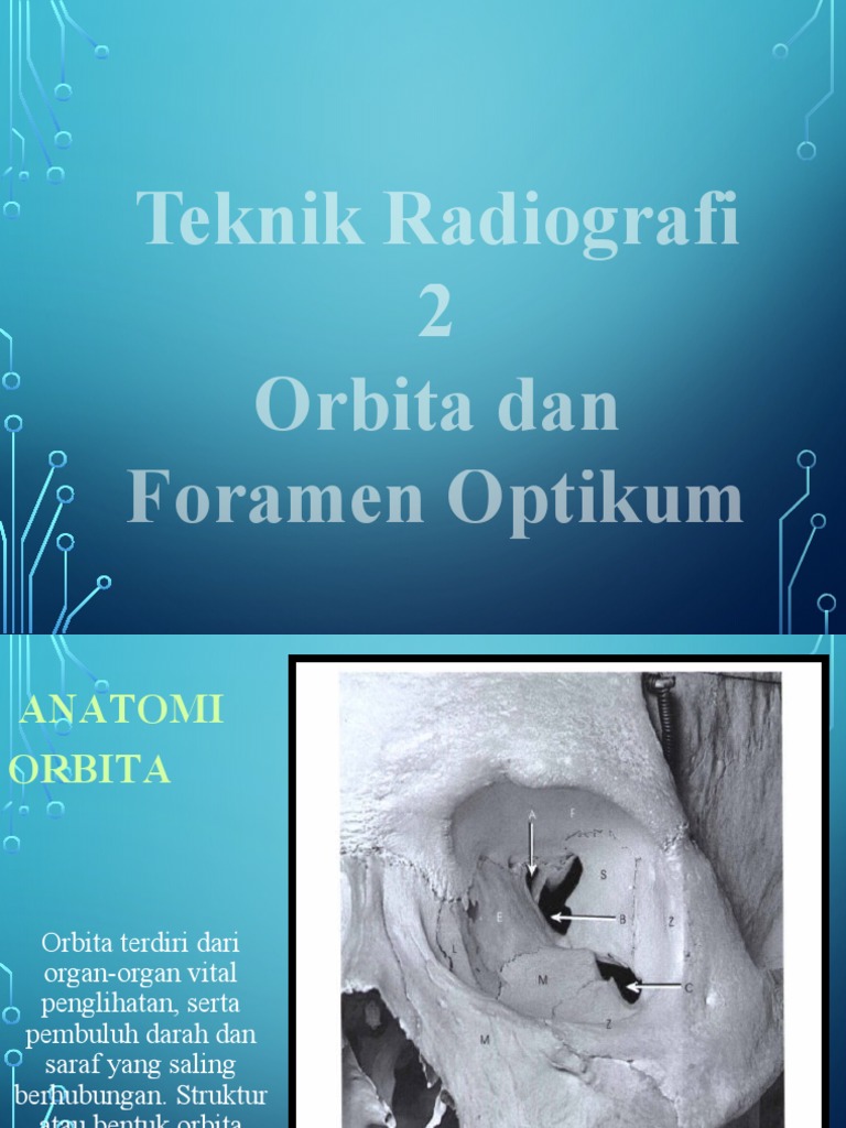 TR Orbita Dan Foramen | PDF