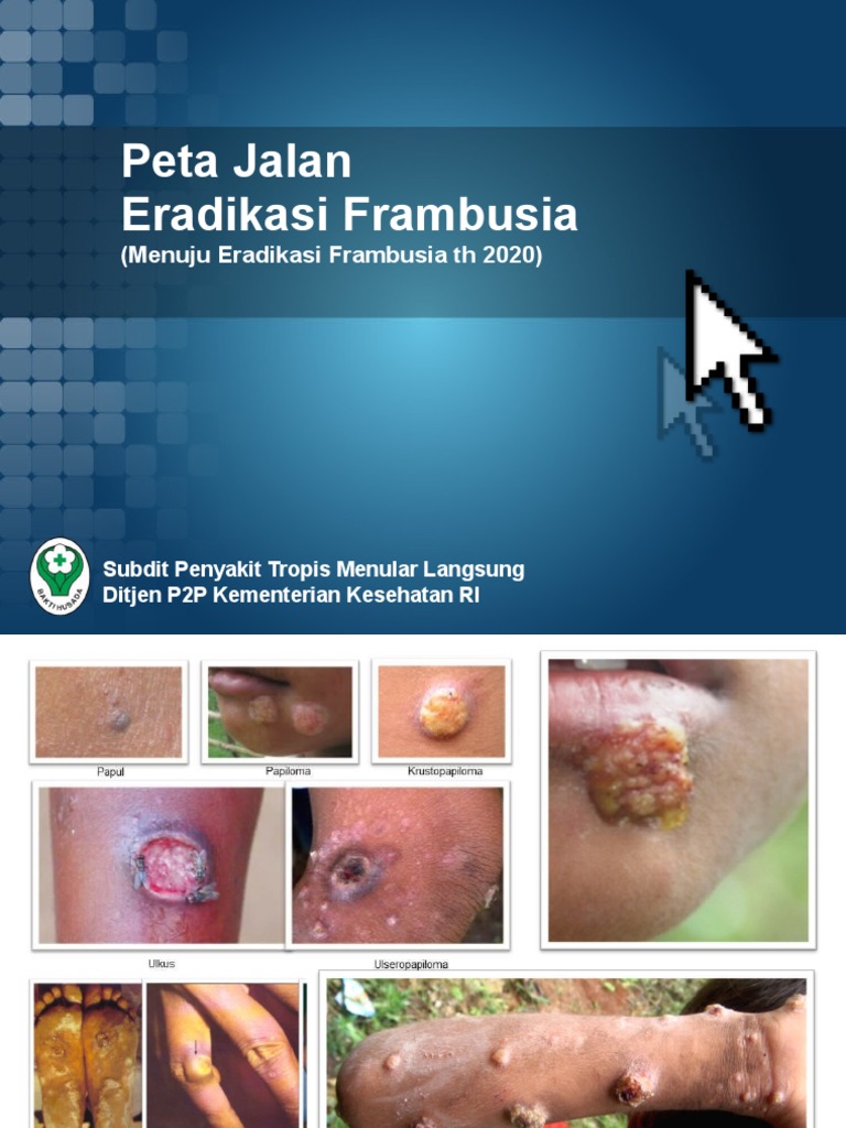 Strategi Eradikasi Frambusia 2020 | PDF
