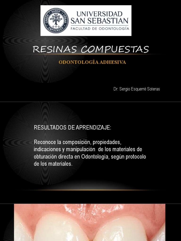 Composición y Propiedades de Resinas Dentales | PDF | Pintura acrilica ...