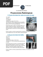 ANEXO TEMA 3 RODILLA-Fosa Intercondilea | PDF | Rodilla | Pelvis