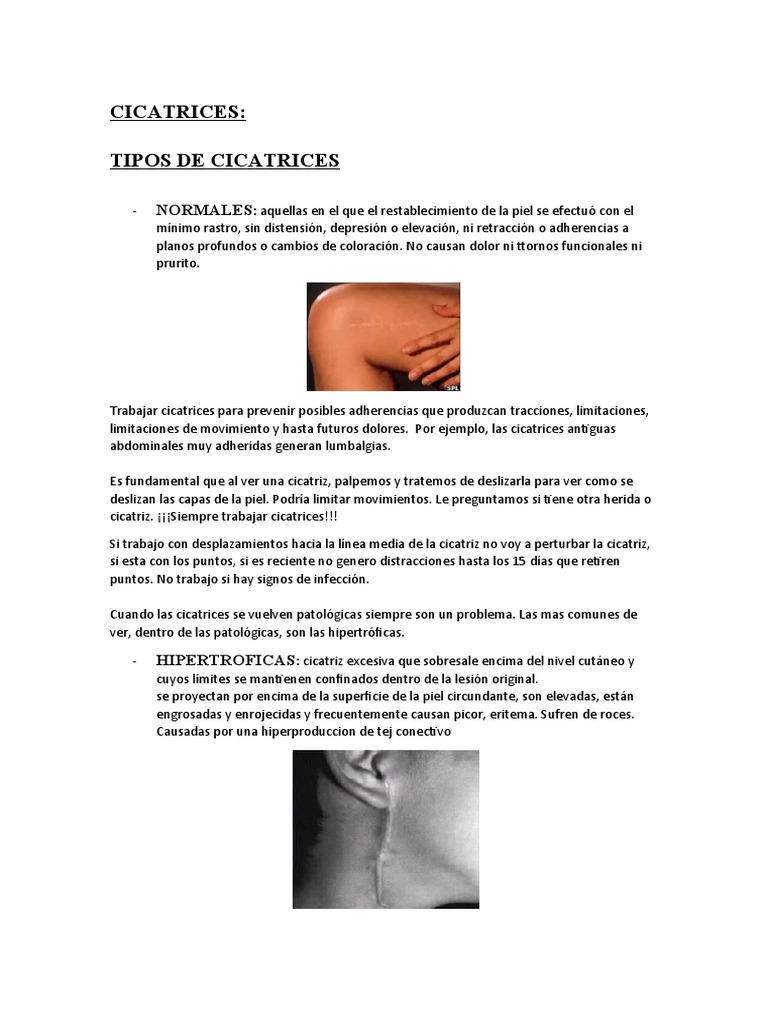 Tipos De Cicatrices Y Cómo Eliminarlas – CBRZ
