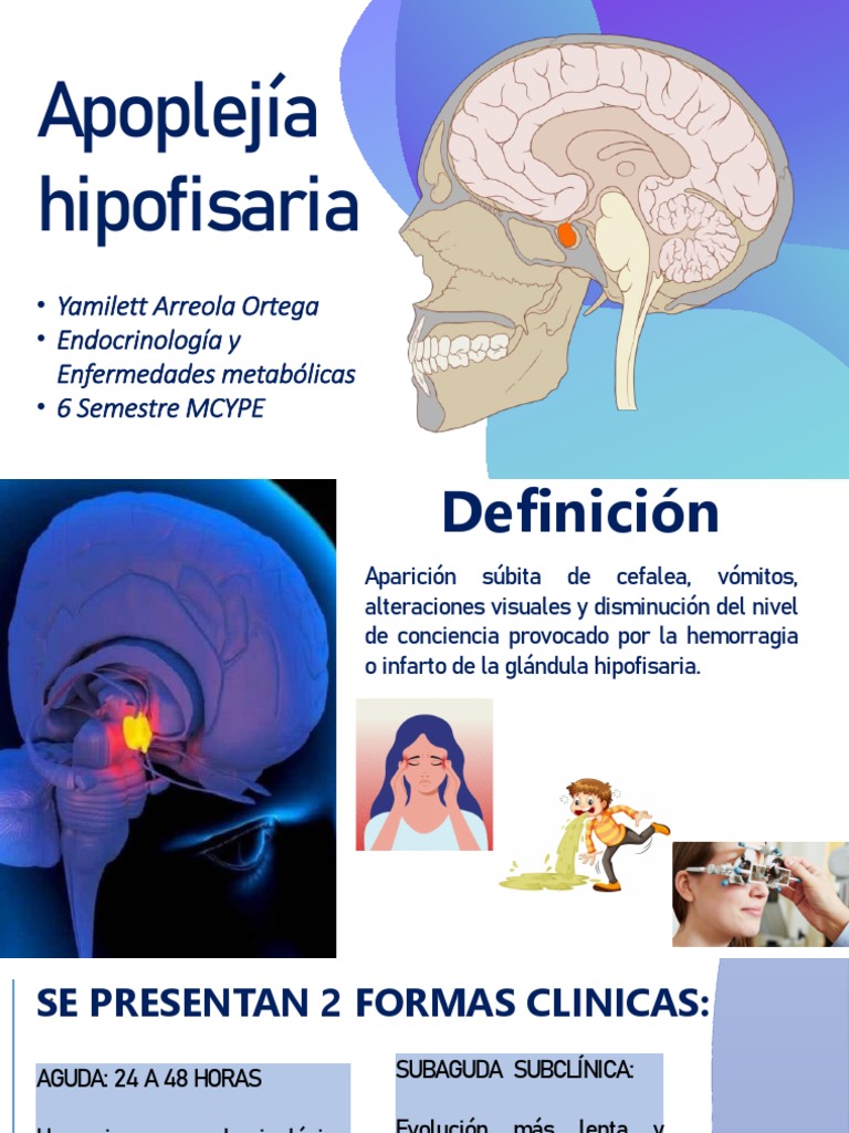 Apoplejia Hipofisaria-Yamilett Arreola | PDF | Especialidades Medicas ...
