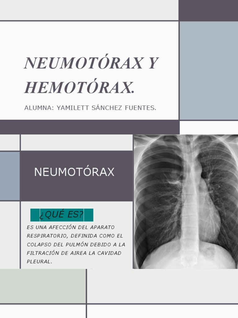 Neumotórax y Hemotórax: Diagnóstico y Tratamiento | PDF