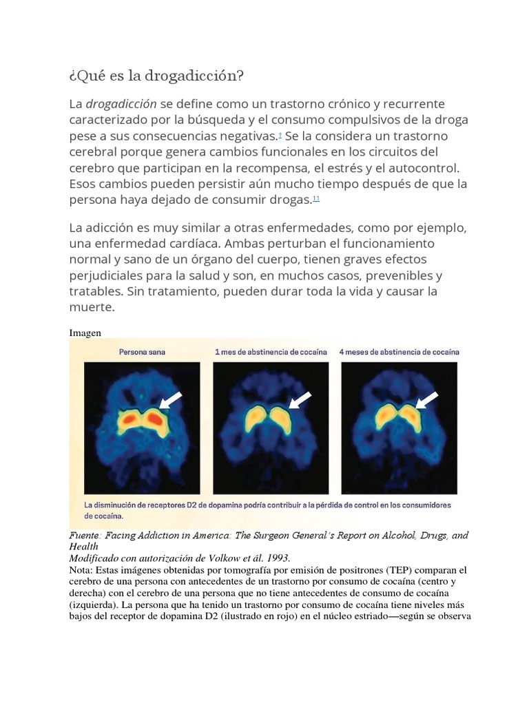 Lo que es la drogadicción | PDF | La dependencia de sustancias | Drogas