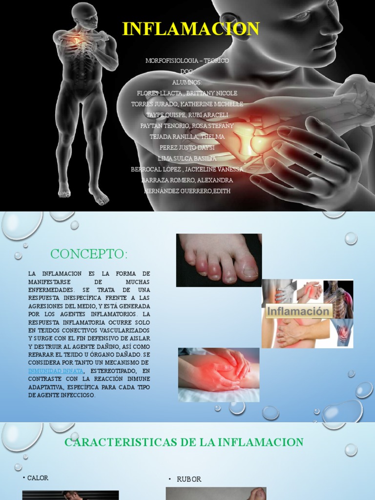 Inflamación: Concepto y Casos Clínicos | PDF | Inflamación ...