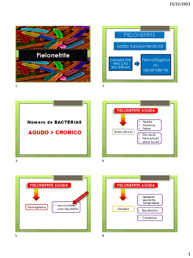 Pielonefrite: Causas, Sinais Clínicos, Diagnóstico e Tratamento | PDF ...