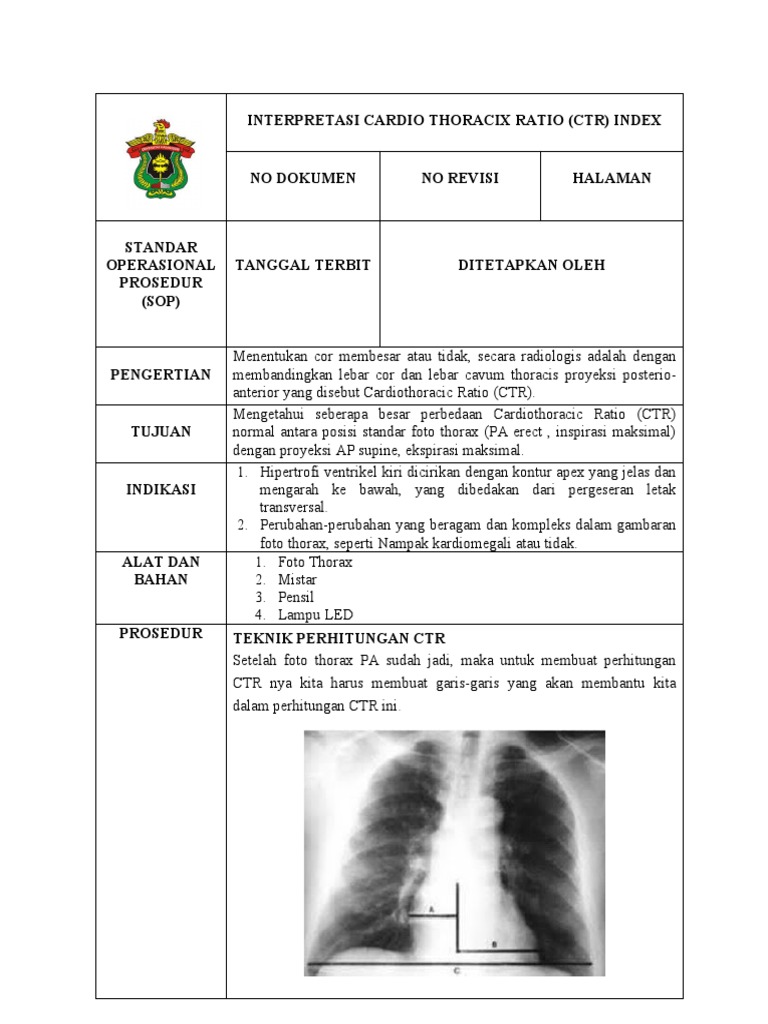 SOP CTR, Defibrilasi Dan Kardioversi | PDF