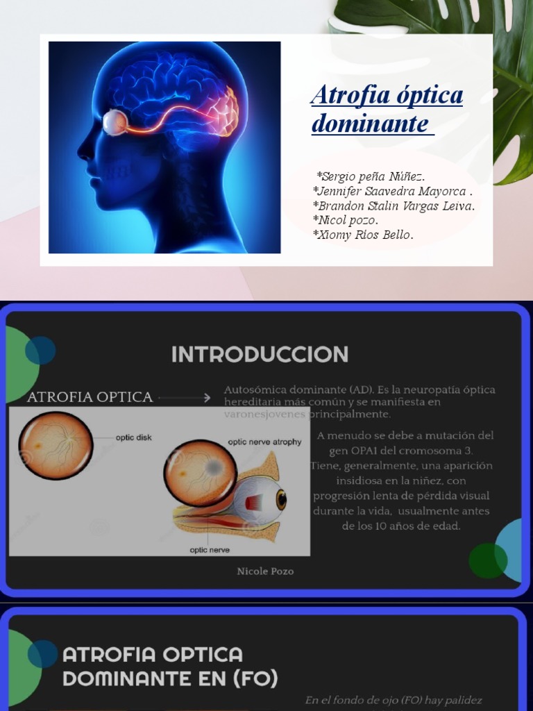 Atrofia Óptica: Diagnóstico y Tratamiento | PDF | Percepción visual ...