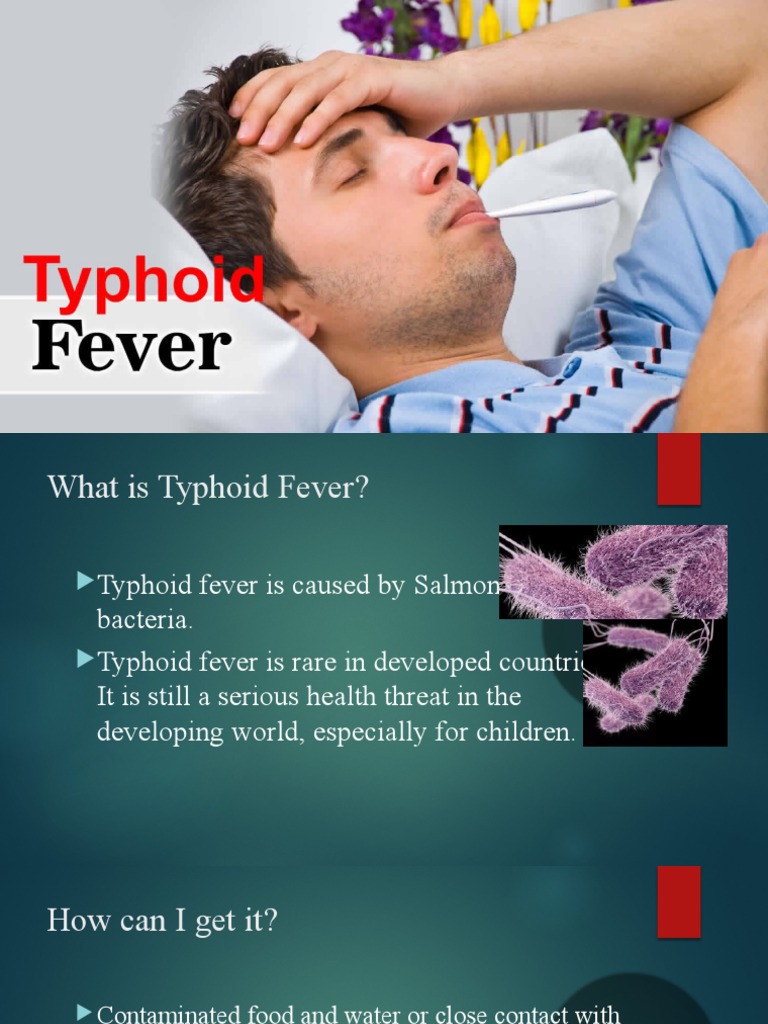 Typhoid Fever Presentation | PDF