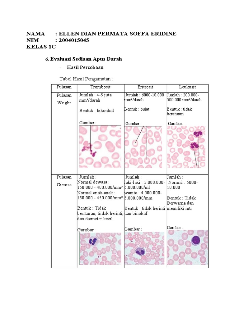 Evaluasi Apus Darah: Wright & Giemsa | PDF | Sains & Matematika