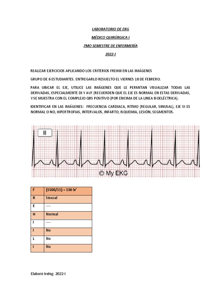 Taller de Ekg 2022 | PDF | Electrocardiografia | Medicina Interna