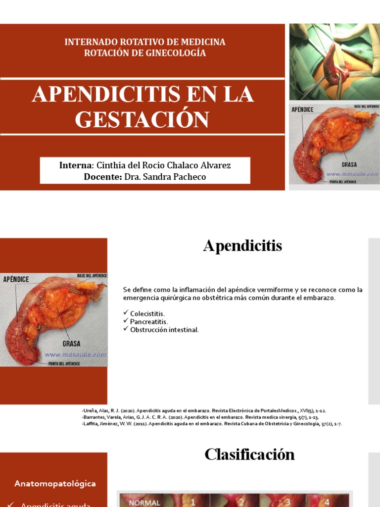 Apendicitis en el Embarazo: Diagnóstico y Tratamiento | PDF | Parto ...