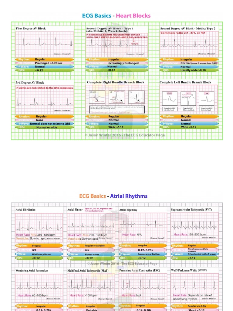 ECG Basics | PDF