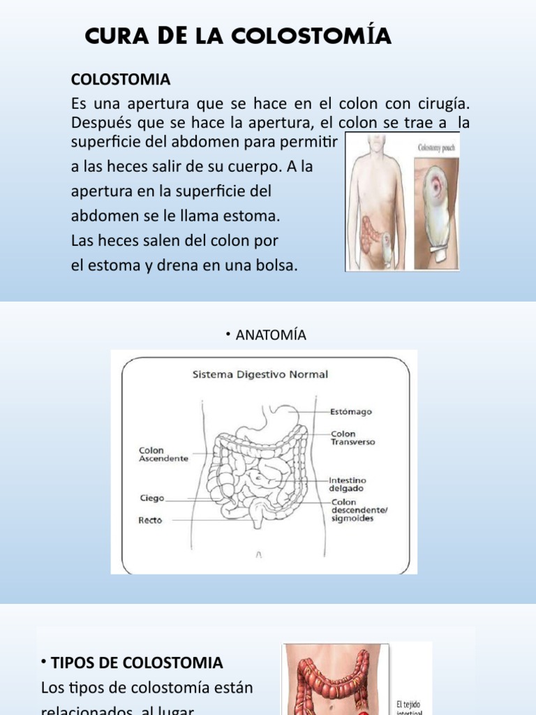 Cuidados y tipos de colostomía | PDF | Intestino grueso