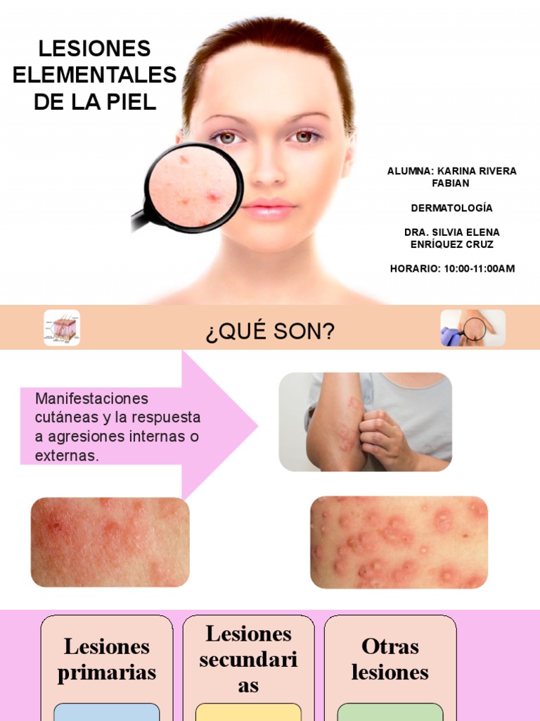 Lesiones de La Piel | PDF | Piel | Psoriasis