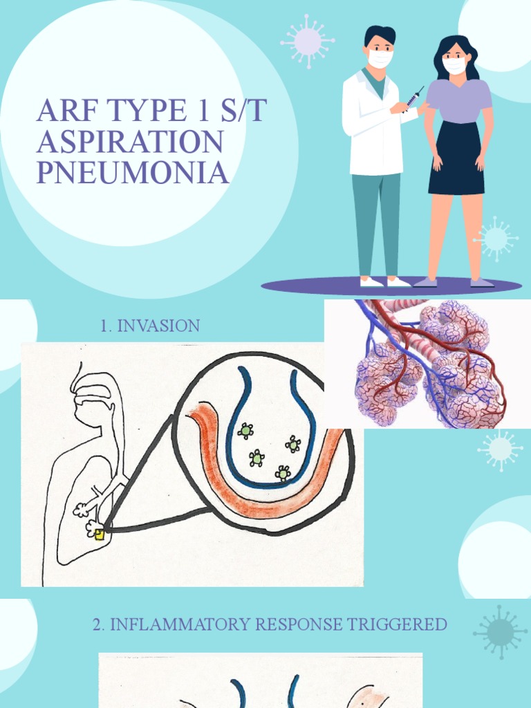 Arf Type 1 S/T Aspiration Pneumonia | PDF