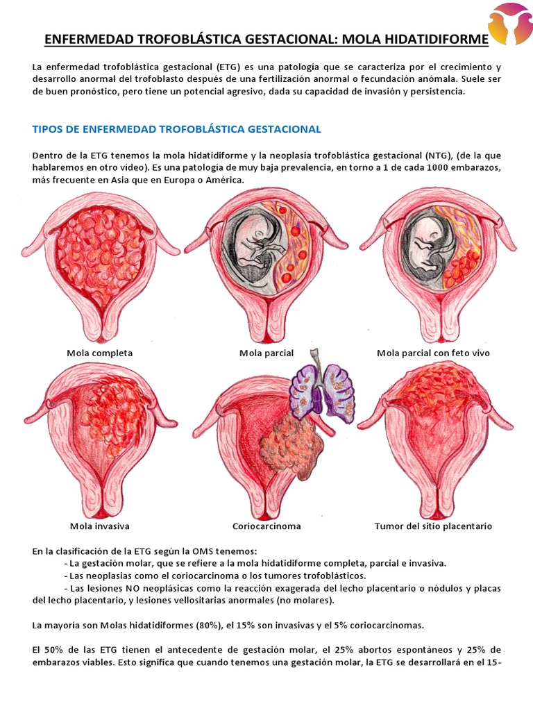 Mola PDF | PDF | El embarazo | Aborto espontáneo