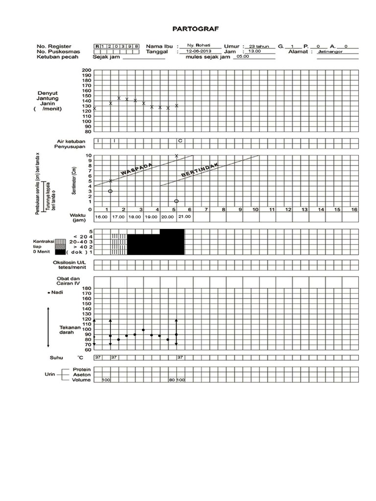 Format Partograf | PDF
