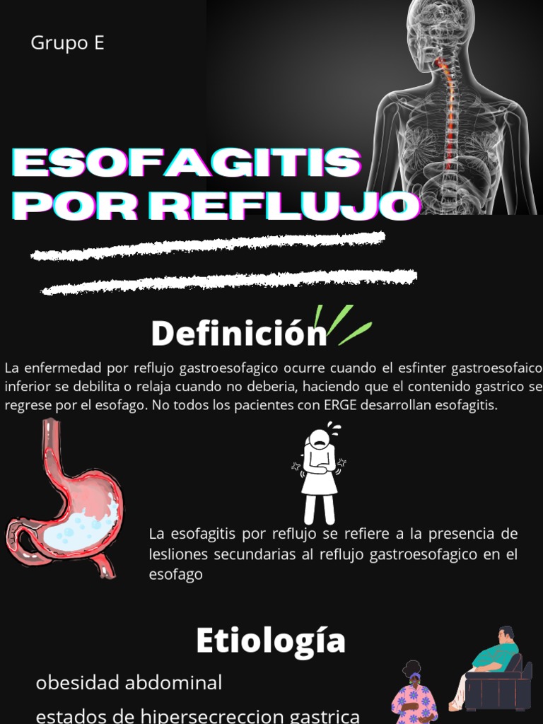 Esofagitis Por Reflujo | PDF | La enfermedad por reflujo gastroesofágico | Gastroenterología