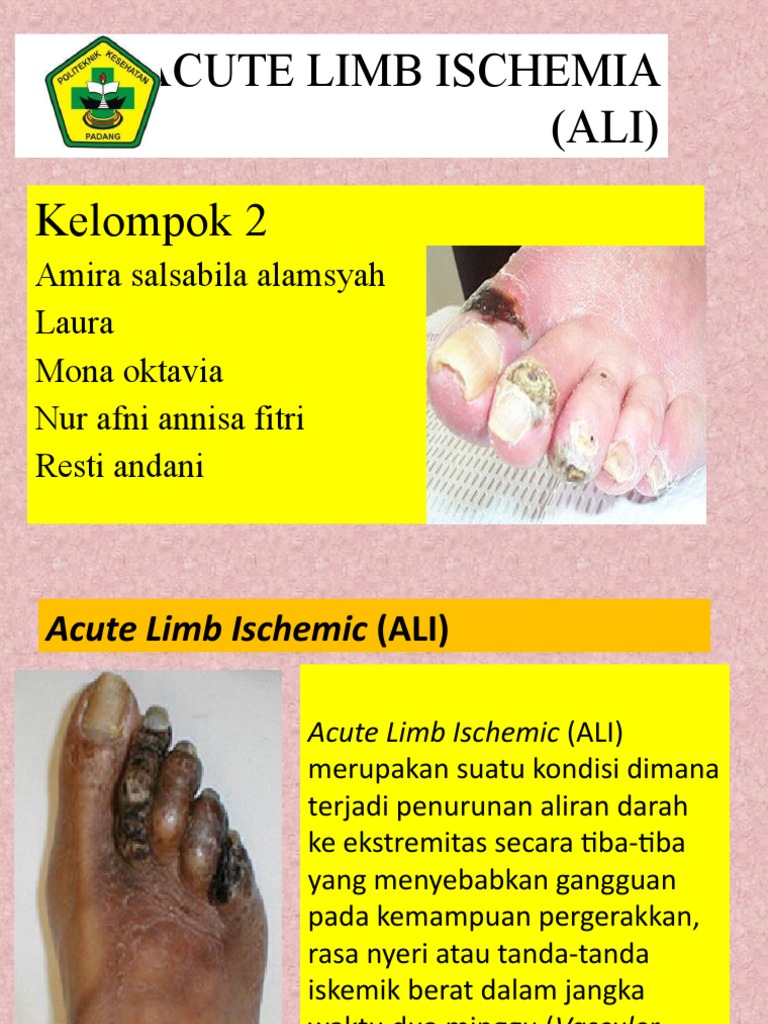 Kel. 2 Acute Limb Ischemia (Ali) | PDF