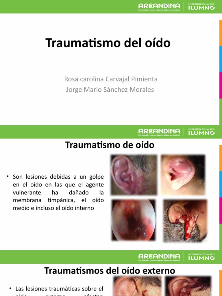 Traumatismo Del Oído Expo de Otorrino Ya | PDF | Lesión | Oído