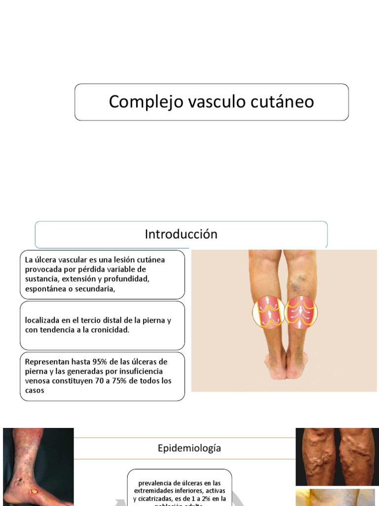 Complejo Vasculo Cutaneo | PDF | Enfermedades y trastornos | Epidemiología