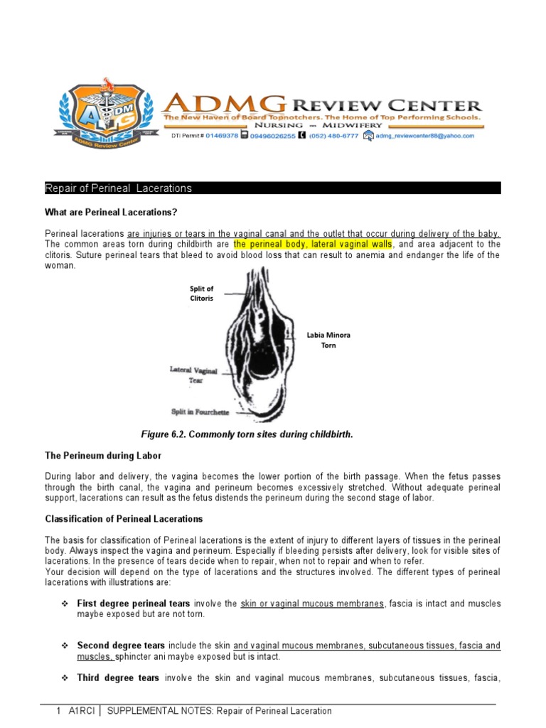 Suturing Perineal Lacerations Edited | PDF | Vagina | Surgical Suture