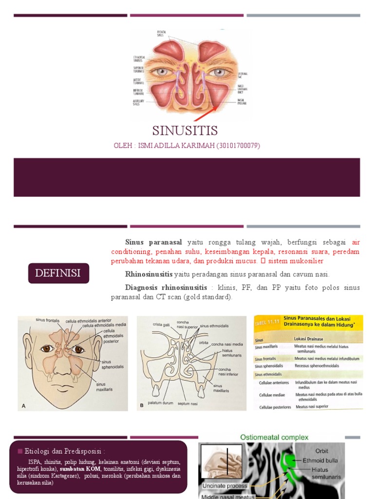 Sinusitis | PDF
