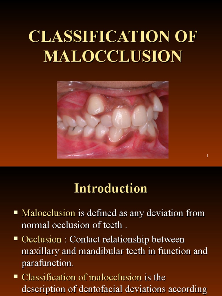 Classification of Malocclusion | PDF | Face | Human Anatomy