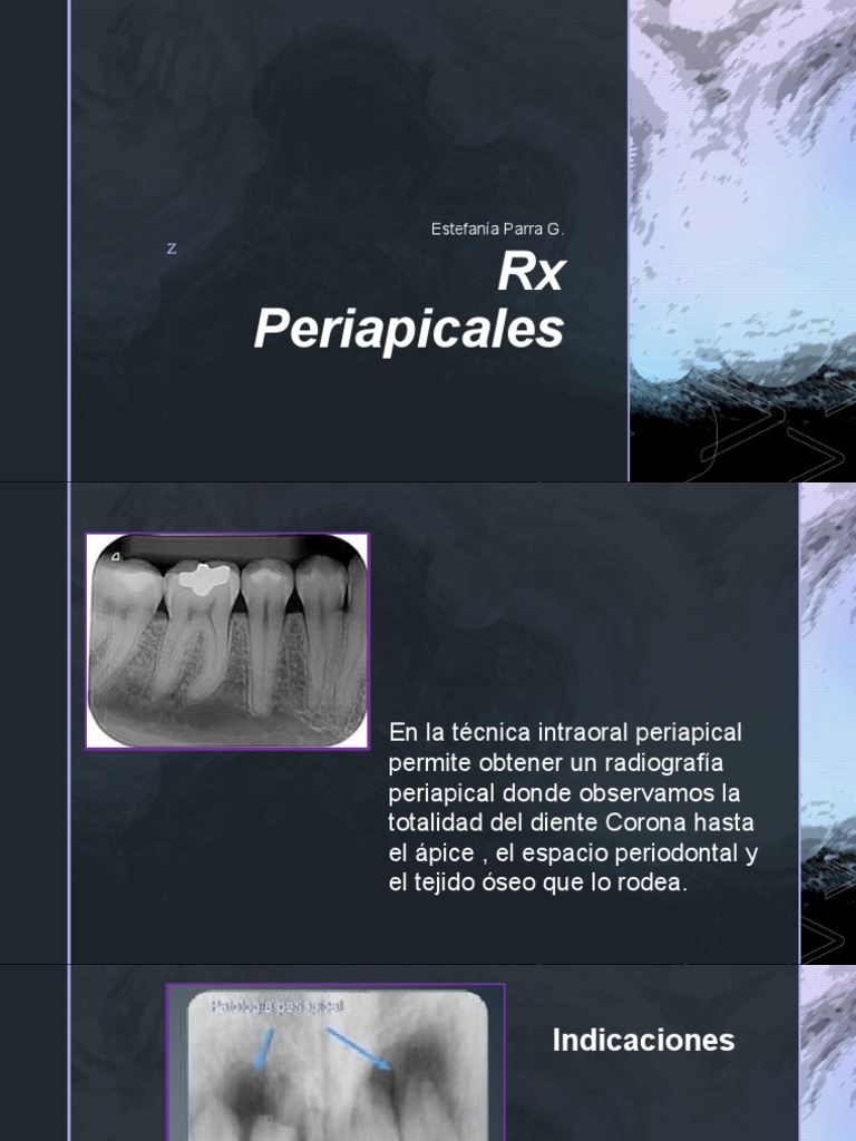 Imagenología Periapical | PDF | Ramas de Odontología | Boca