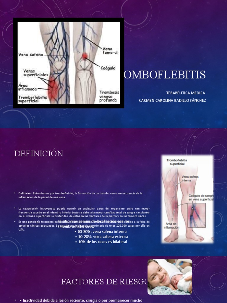 TROMBOFLEBITIS | PDF | Trombo | Ciencias de la Salud