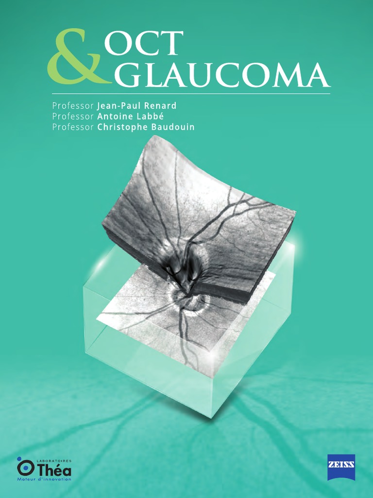 OCT and Glaucoma | PDF | Retina | Visual System
