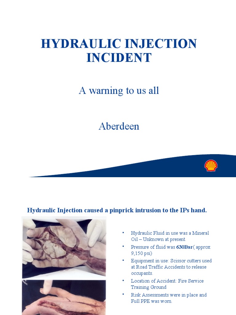 Hydraulic Injection Injury Case Study | PDF | Technology & Engineering