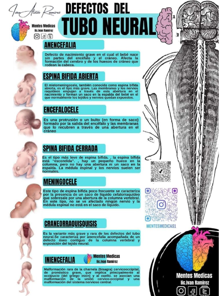 Defectos Del Tubo Neural | PDF