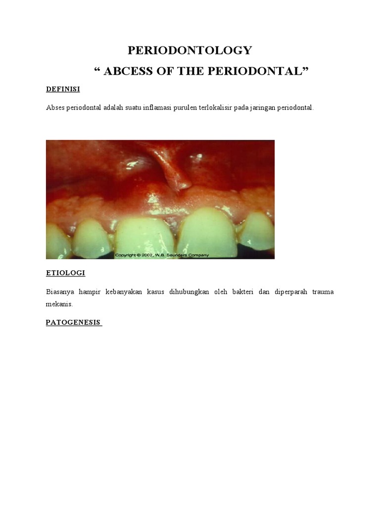 Abses Periodontal | PDF
