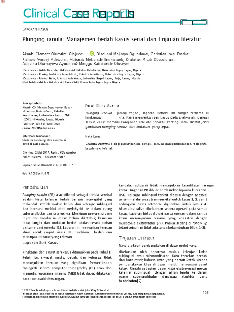 Plunging Ranula Surgical Management of Case Series and The Literature ...