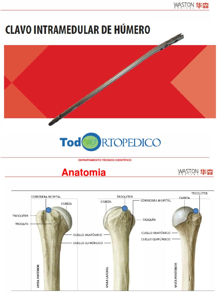 Clavo Húmero | PDF | Hombro | Anatomía