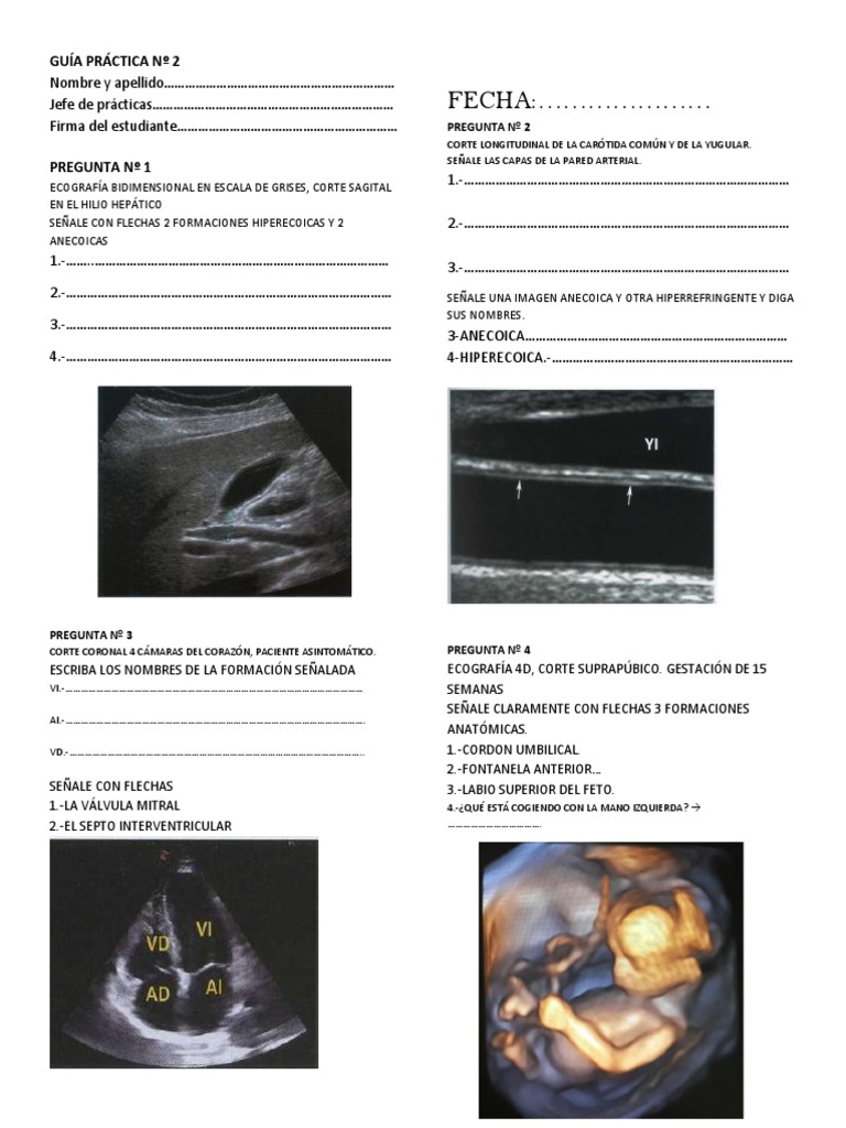 Guia Practica #2 | PDF
