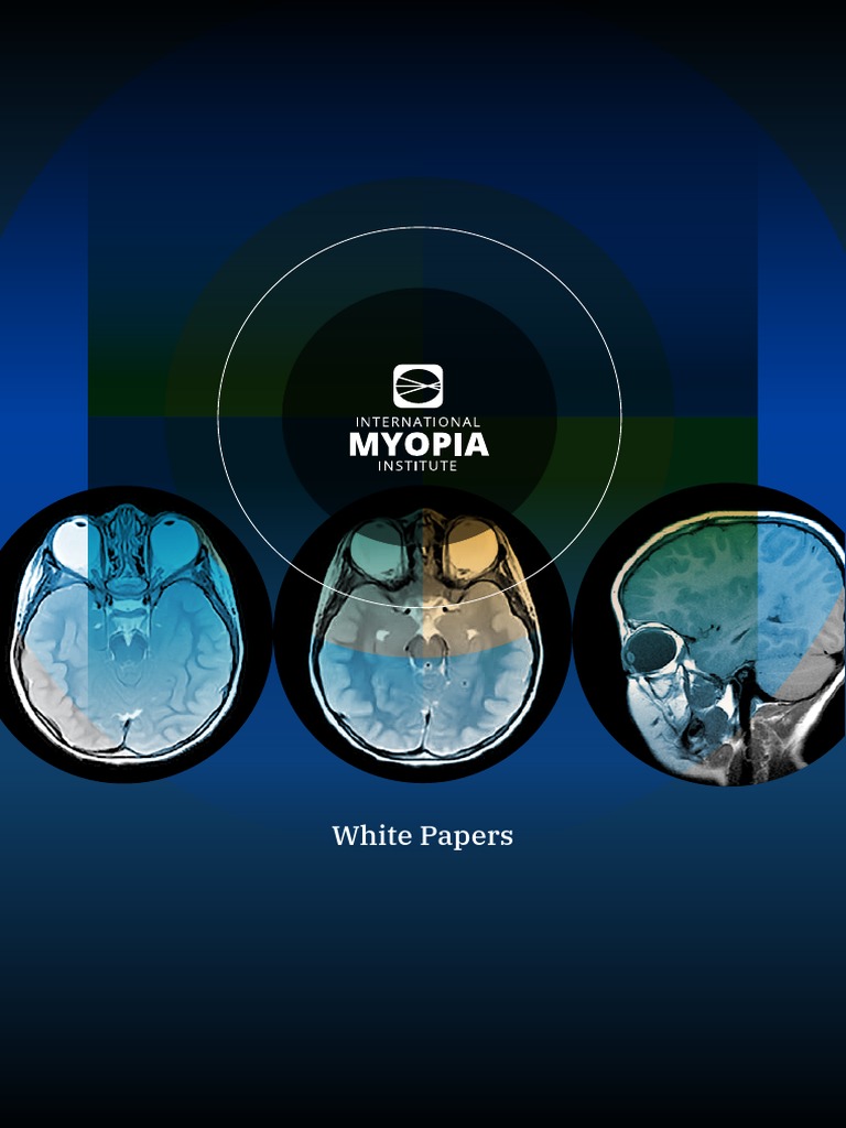 1.-IMI - White Papers Book | PDF | Optometry | Myopia