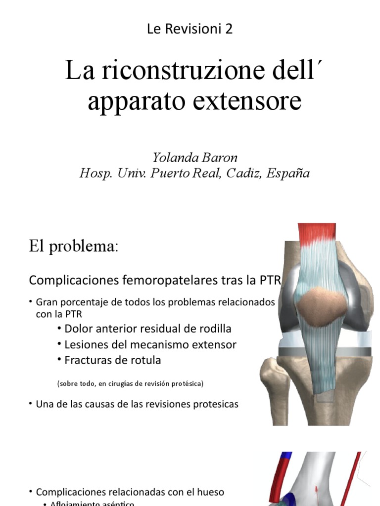 La Reconstrucción Del Aparato Extensor de Rodilla | PDF | Rodilla | Hueso