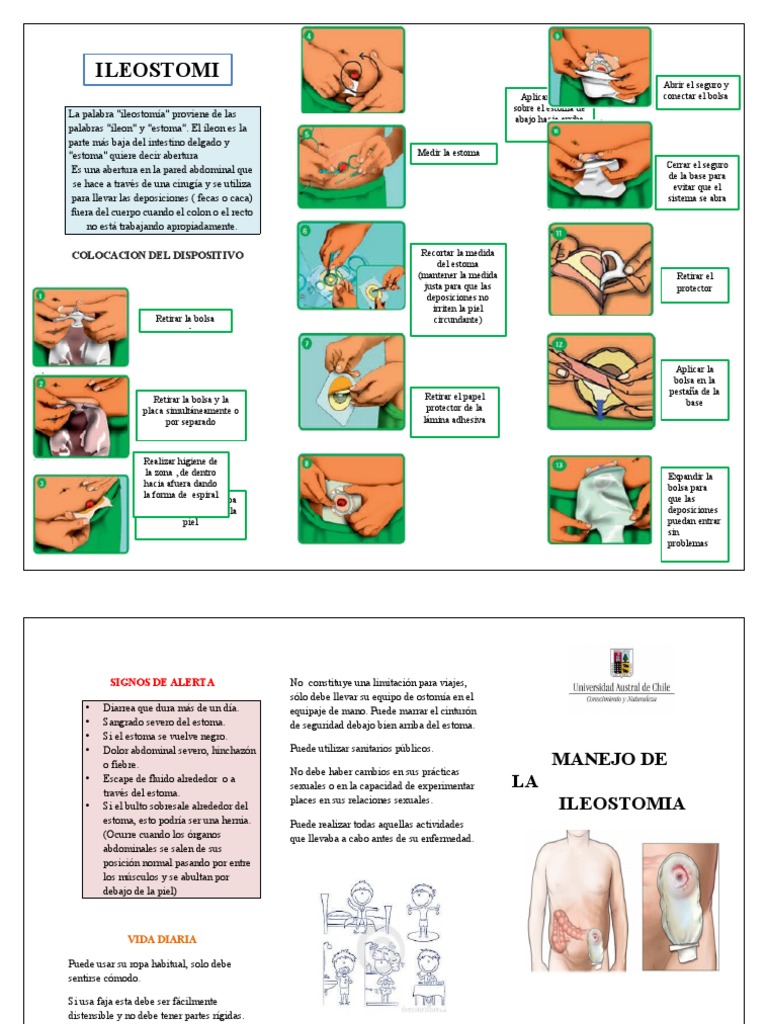 Manejo y cuidados de ileostomía | PDF | Heces | Abdomen