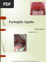 Faringitis Bacteriana y Viral | PDF | Estreptococo | Ciencias de la Salud
